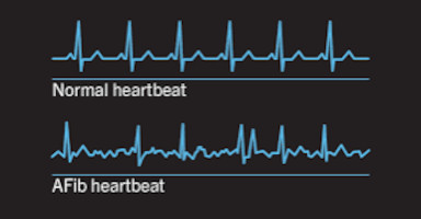 September is National Atrial Fibrillation Month - The Madison Times